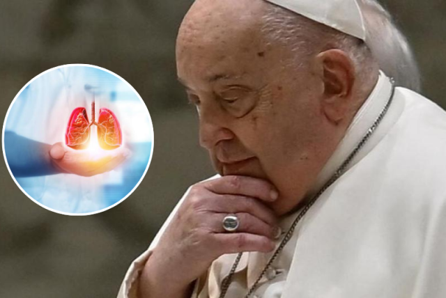 Salud del Papa Francisco | ¿Qué es la bronquiectasia y cómo afecta recuperación tras últimas ...
