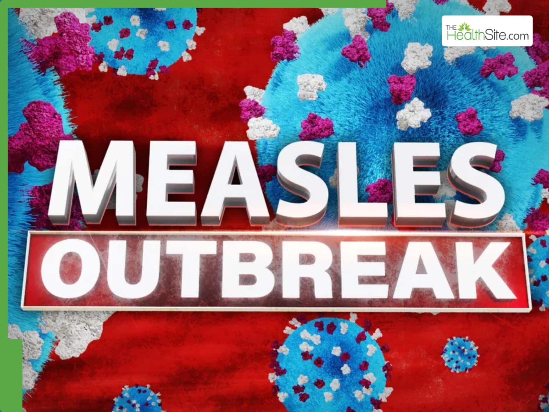 Measles Outbreak In US Hits Record High: CDC Deploys Disease Experts To ...