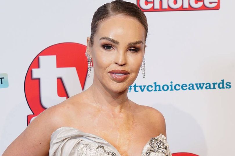 ITV's Katie Piper felt 'lethargic and hungover' without drinking before ...