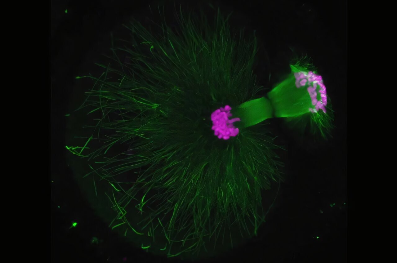 Why aged oocytes struggle to repair DNA damage