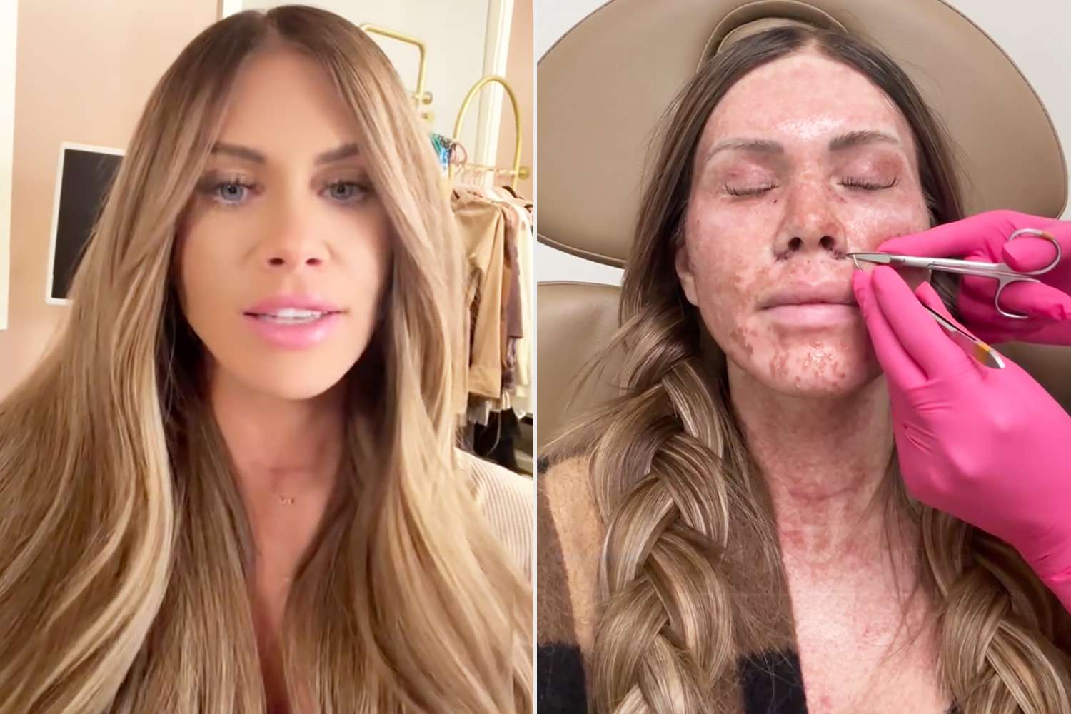 “Mormon Wives ”Star Jessi Ngatikaura Documents $2K+ Nose Job After ...