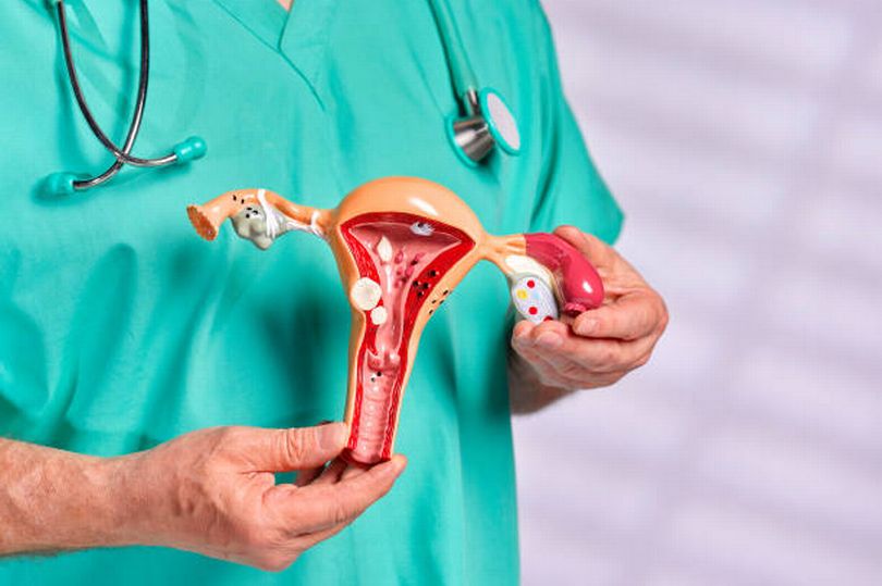 Womb cancer's earliest symptoms and how the disease is treated