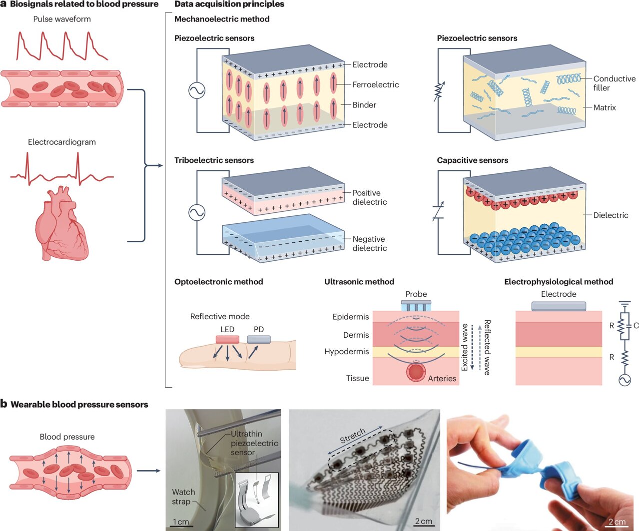 AI-driven wearable blood pressure sensors promise continuous health ...