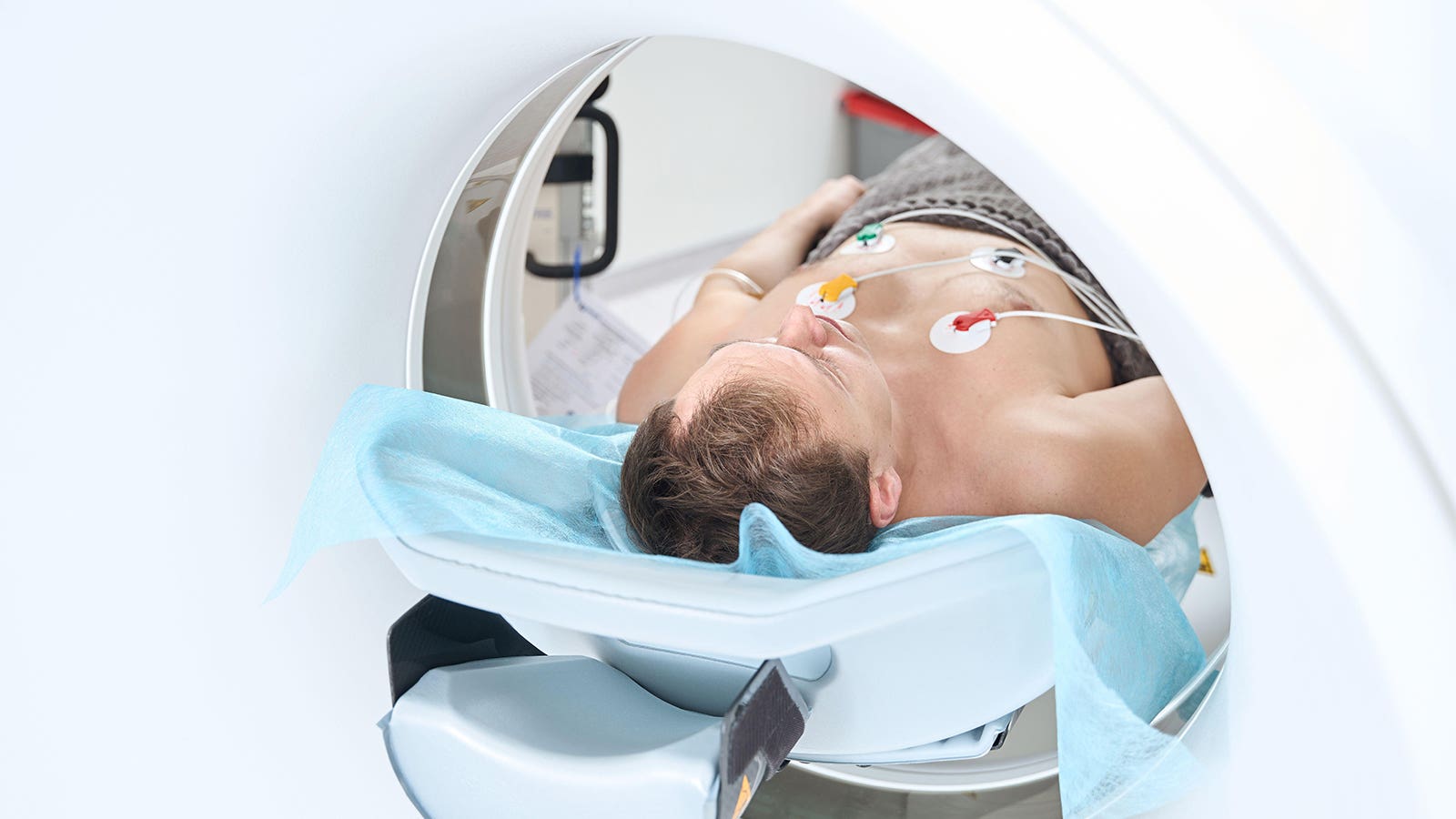 Coronary Plaques Reined in With Coronary Calcium Scans in the Picture