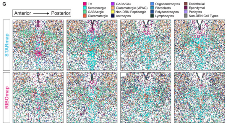 The science behind feeling full: How your brain knows when to stop eating