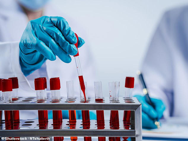 Fears raised over accuracy of DIY blood tests for prostate cancer