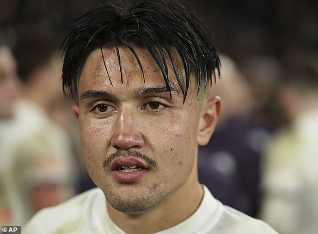 Marcus Smith DROPPED for England's Six Nations clash with Italy as ...