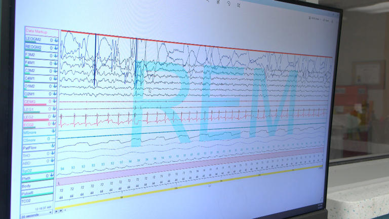 MUSC sleep specialist discusses hidden health impact of daylight saving ...