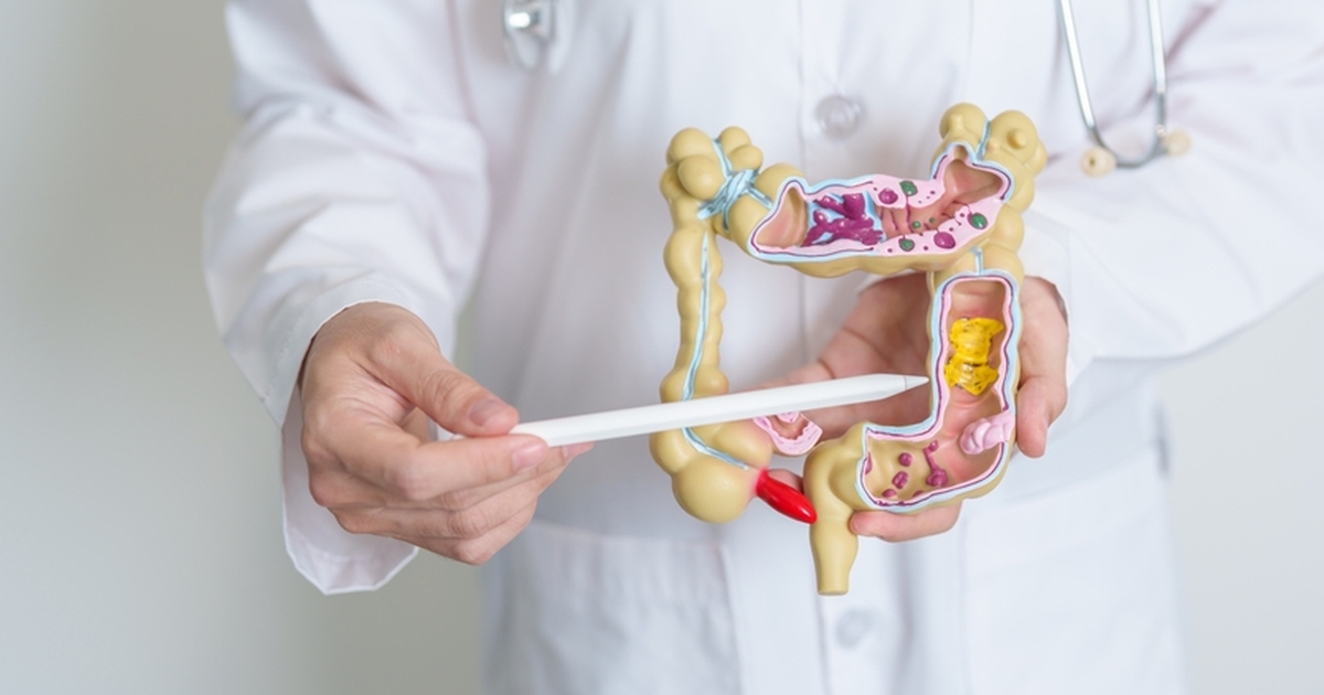 8 Important Symptoms of Colorectal Cancer – and 5 Factors That May ...