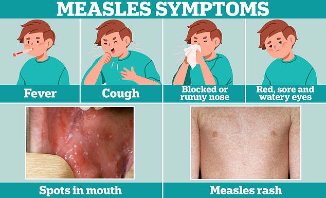 As airports signal red alert over measles outbreaks, how to stay safe