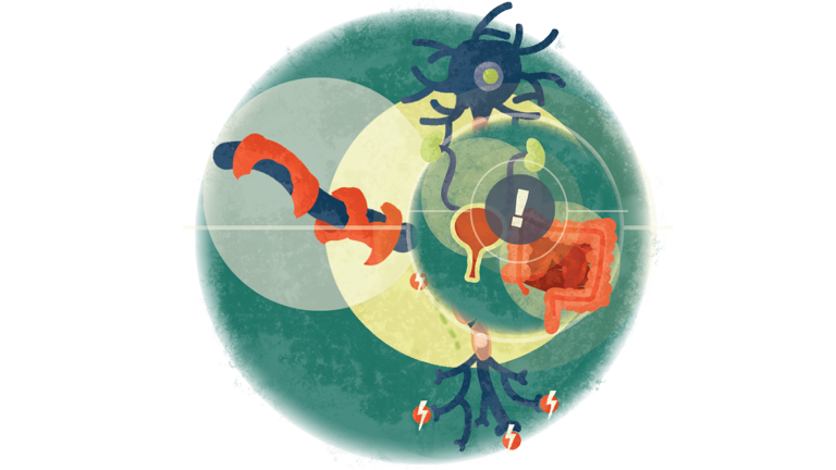 Helping MS Patients With Bladder and Bowel Problems