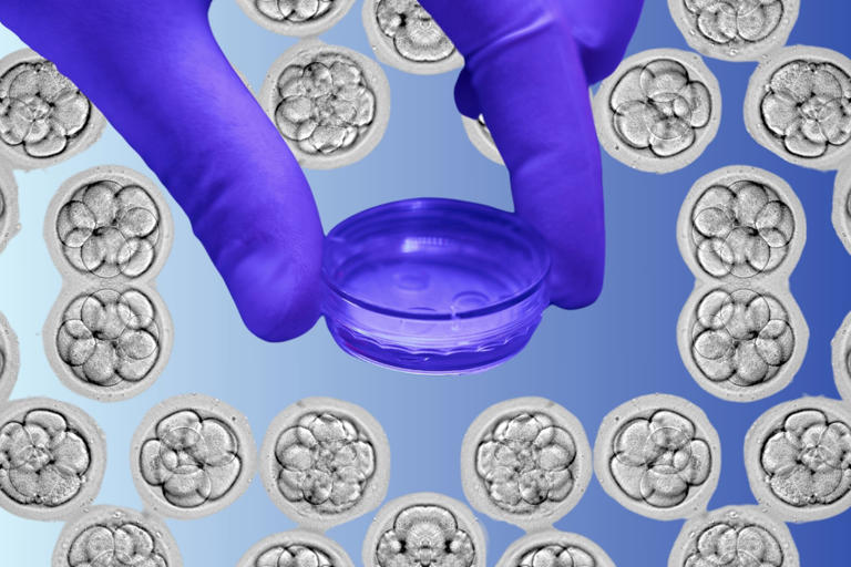 IVF Patients Say a Test Caused Them to Discard Embryos. Now They're Suing