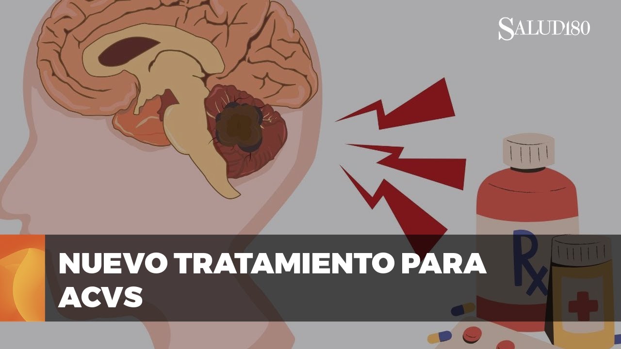 TNKase: El nuevo tratamiento aprobado por la FDA para ACVs