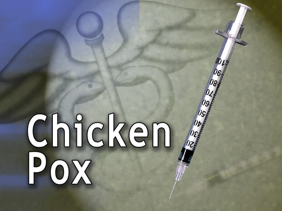 Confirmed case of chicken pox at Woodland Park High School and Middle ...