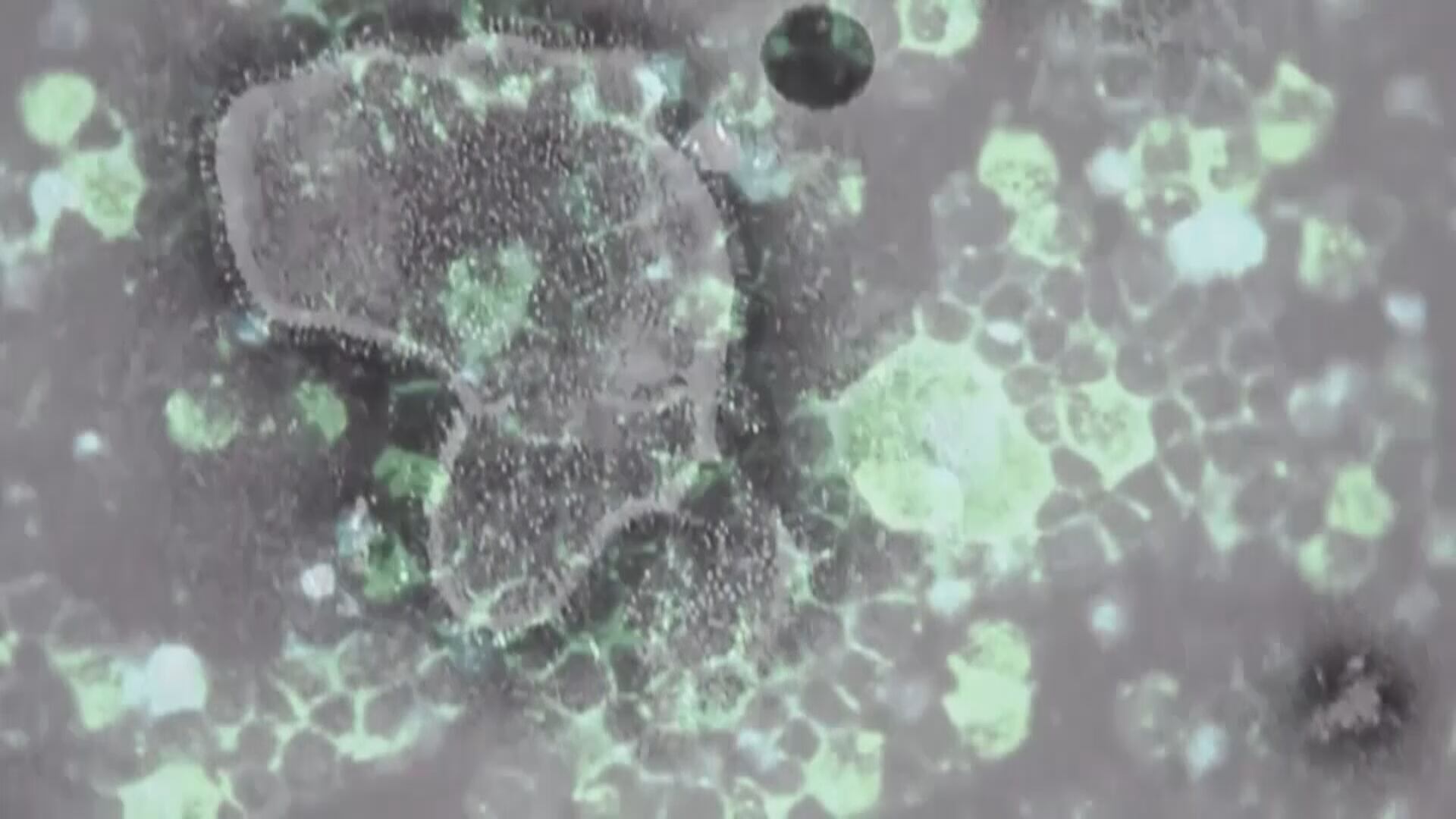 2024-2025 Flu season classified highly severe by CDC