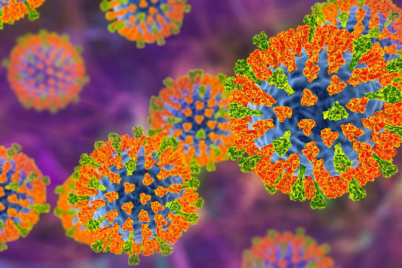 Second person dies after contracting measles in US outbreak Second person dies after contracting measles in US outbreak