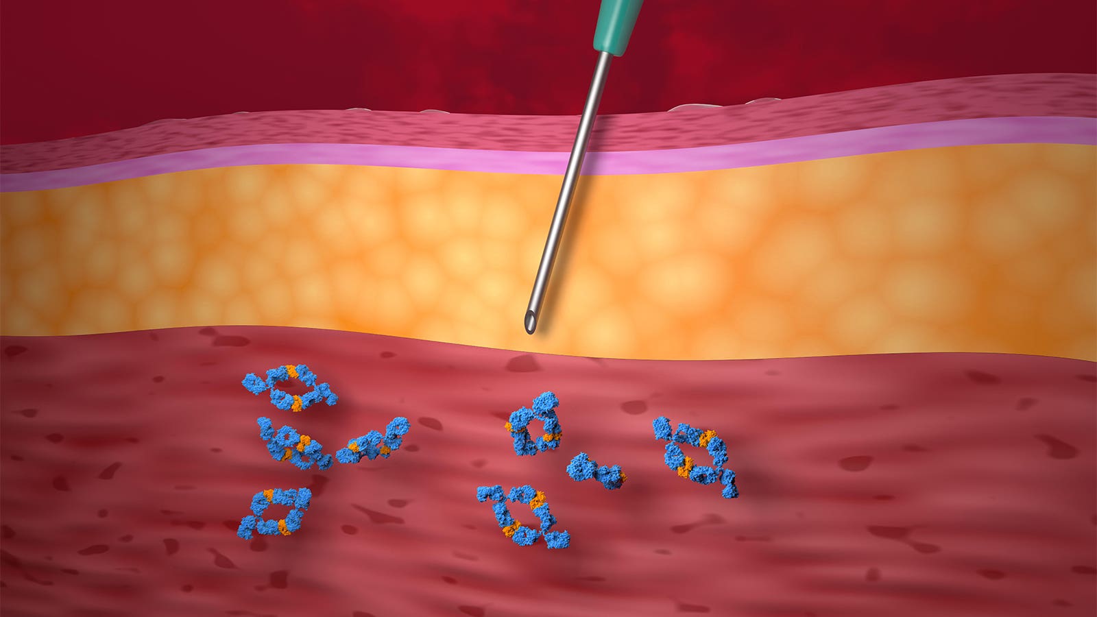 Humira Copycats for Psoriasis Backed by Real-World Outcomes