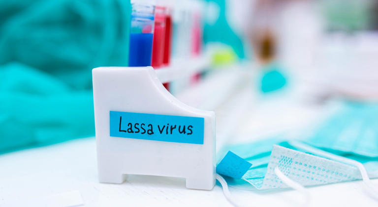 Bleeding eye virus Lassa fever could be in UK after case arrived from ...