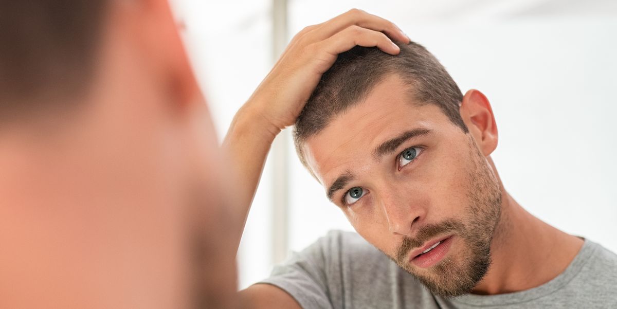 6 Reasons Men Bald – and What Can Be Done About It, According to a Hair ...