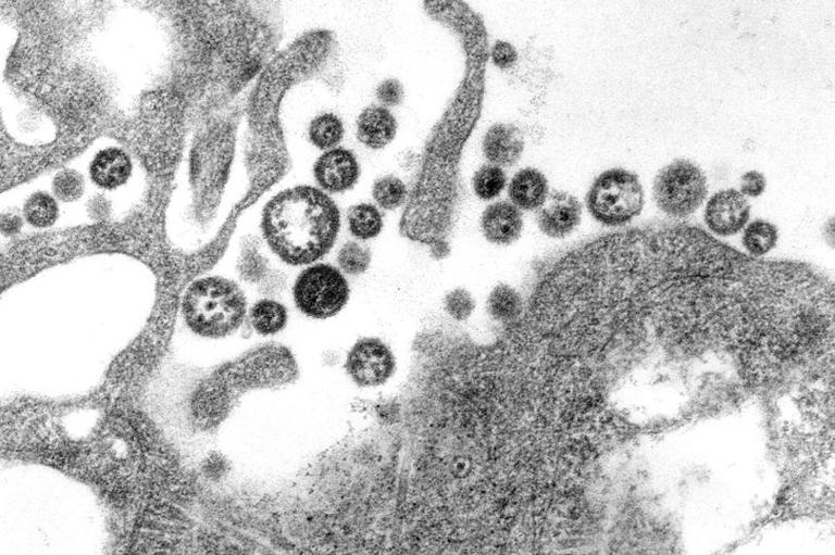 UK alert after discovery of case of Ebola-like disease that causes ...