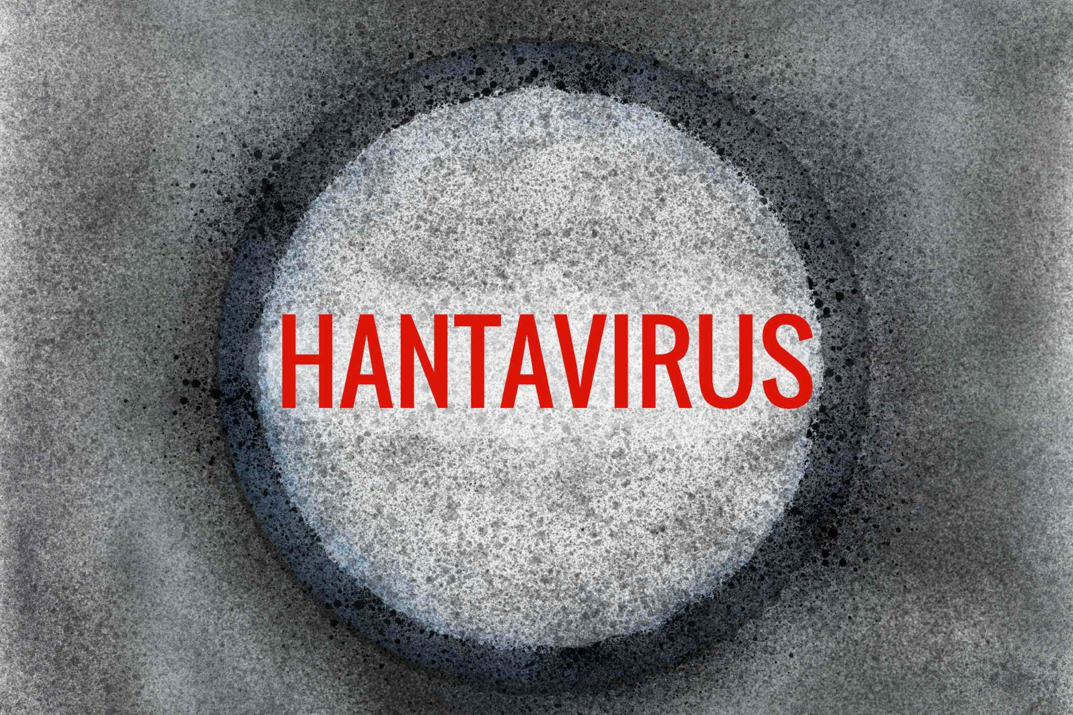What is hantavirus? What to know about the virus that killed Gene ...