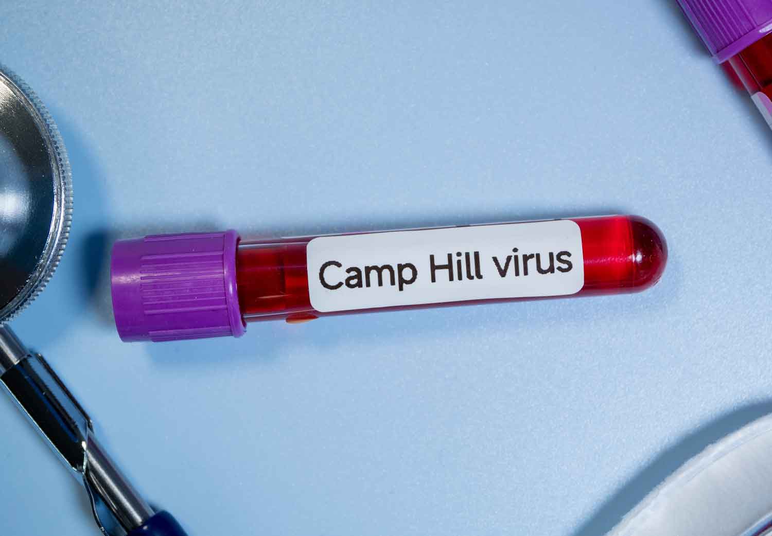 Virus Camp Hill: ¿qué tiene que ver con el henipavirus?