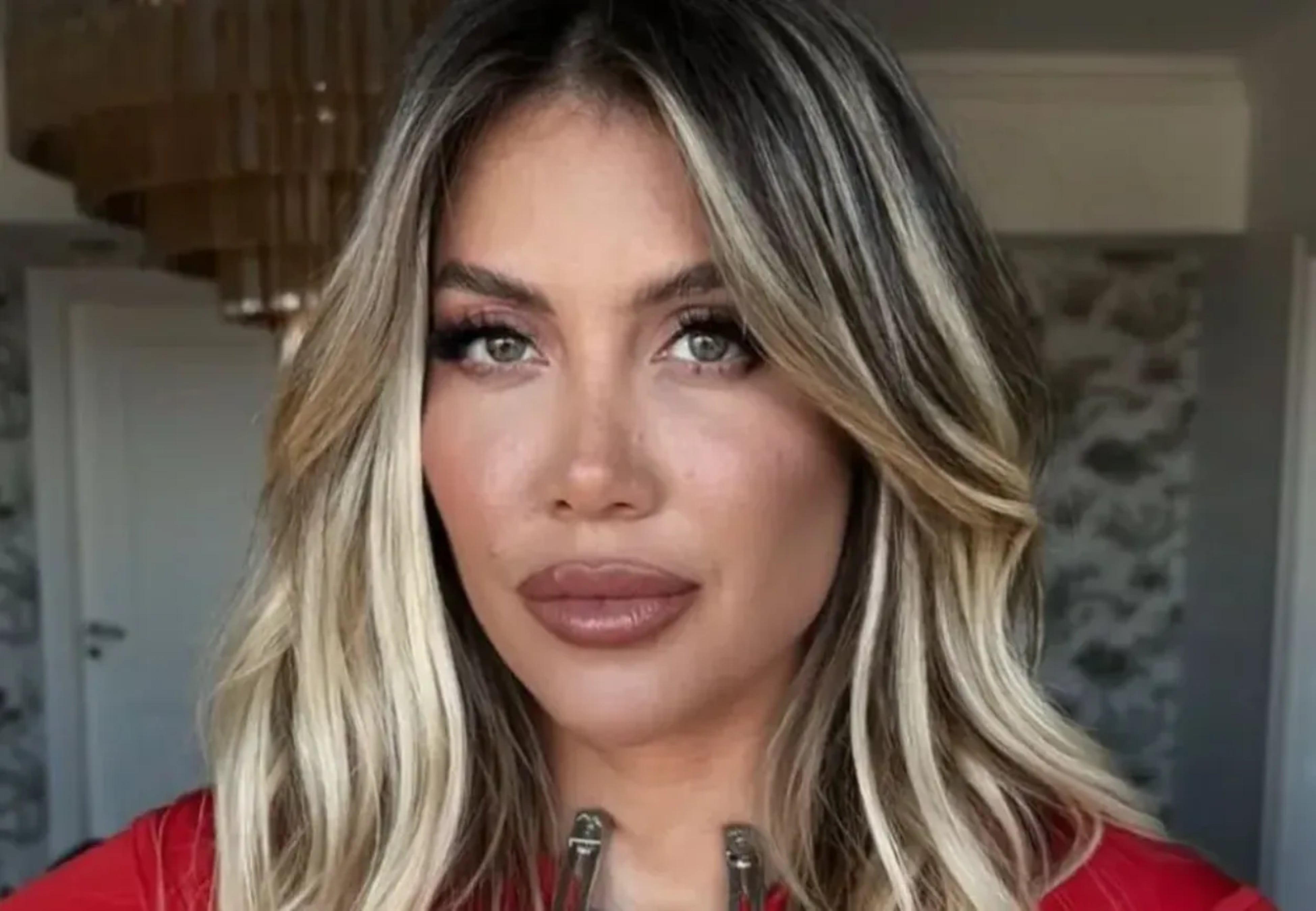 De qué se operó Wanda Nara antes de su pelea con Mauro Icardi en el ...