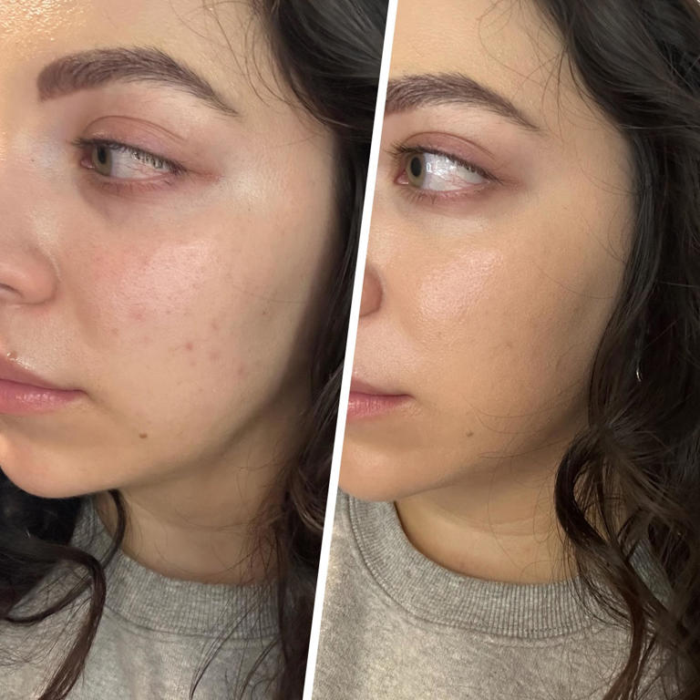 Dry complexion? These skin tints provide subtle color and hydration