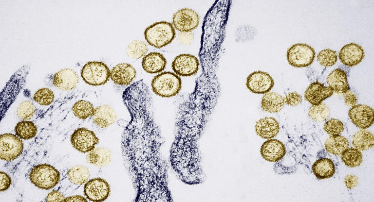 What is hantavirus? The rodent-borne disease officials say killed Gene ...