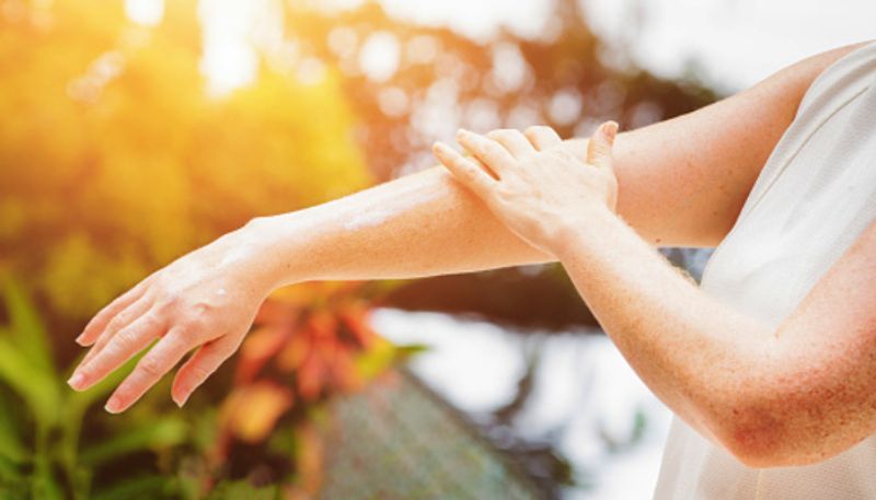 Summer heat causing rashes already? Check THESE 5 tips to get relief