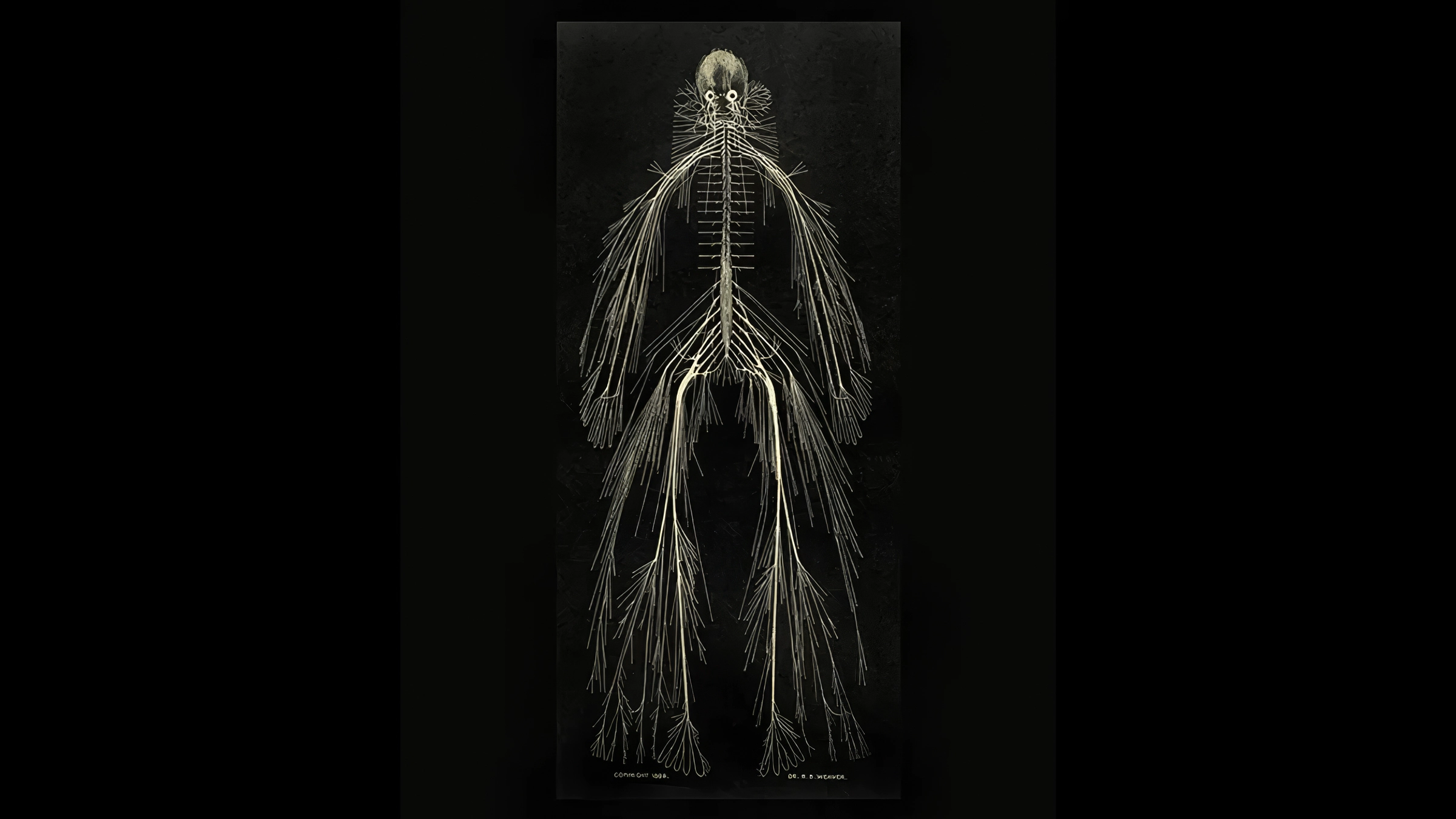 Le mystère de Harriet Cole : l’histoire troublante d’un corps disséqué ...