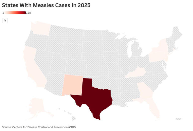 US Measles Map Reveals Worst Hit States as Cases Surge
