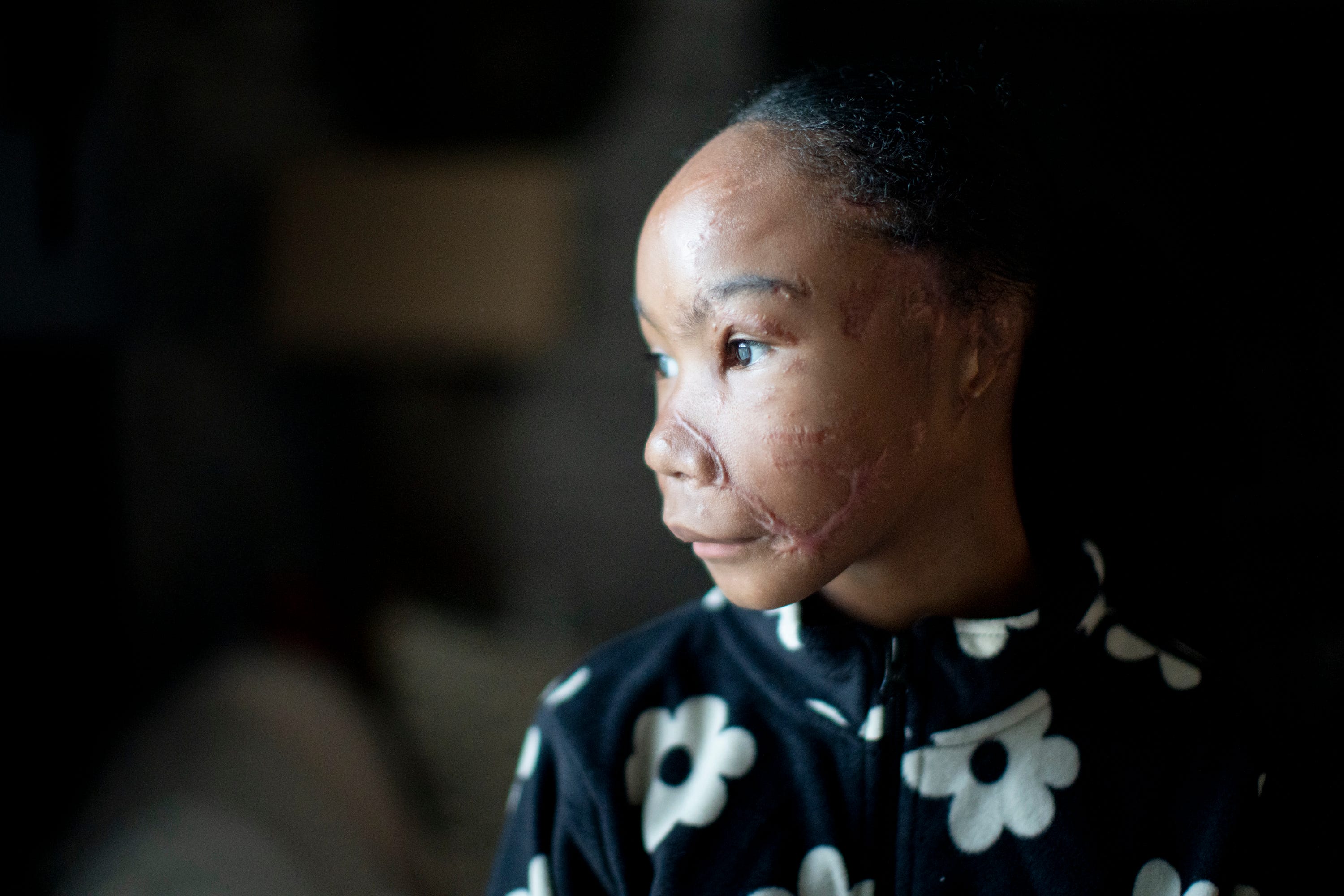 'Just tell me if my daughter's alive.' After near fatal dog attack ...