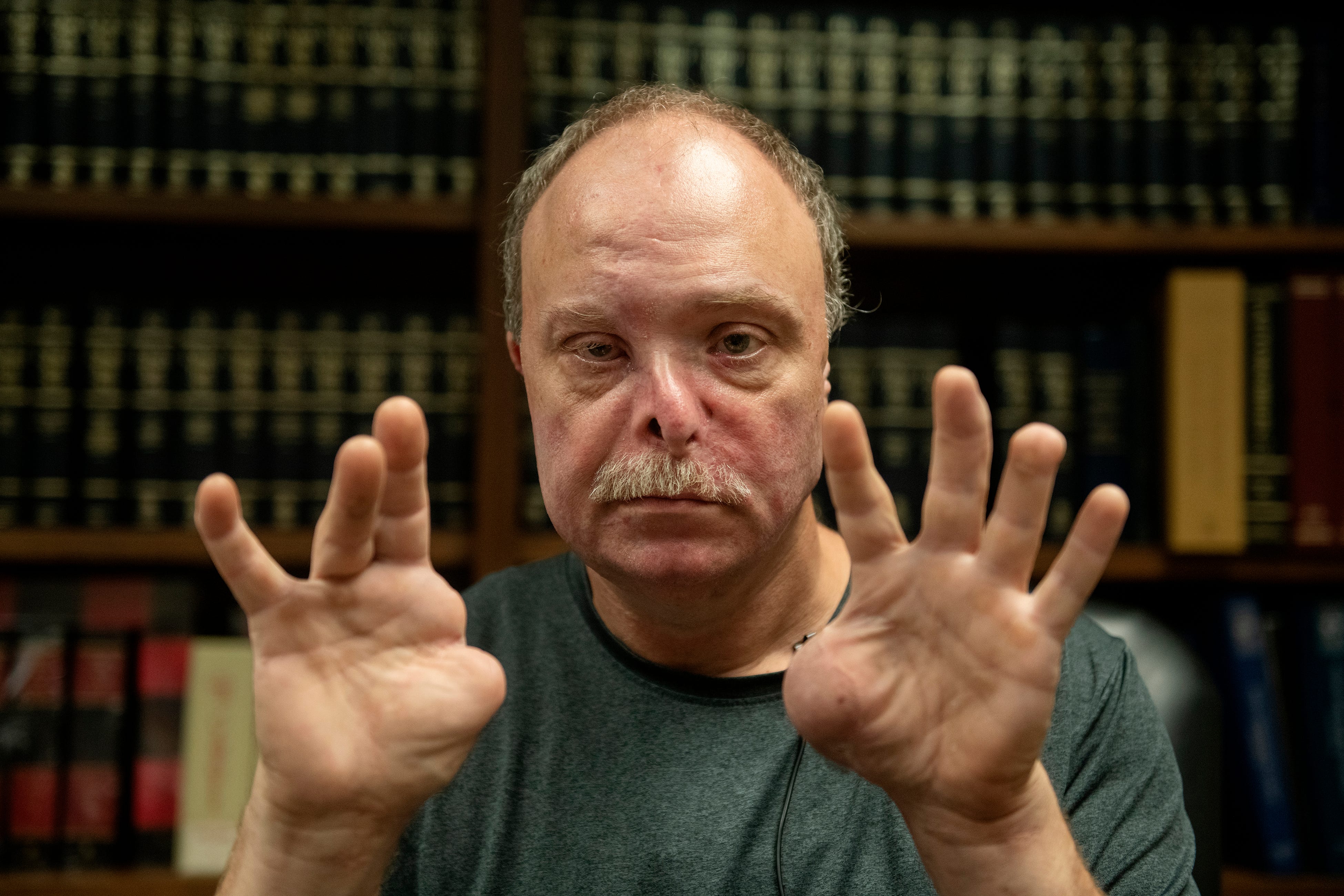 Man mauled by Green neighbor's dog still suffers from the attack