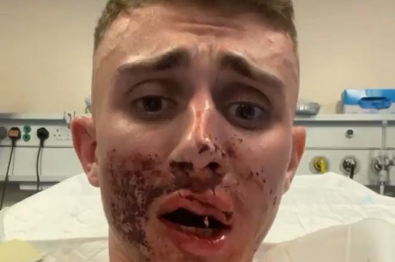 Olympian Jack Woolley glad Kellie Harrington was not there when he was ...