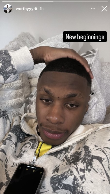 Chiefs' Xavier Worthy Makes Clear Change in Physical Appearance After ...