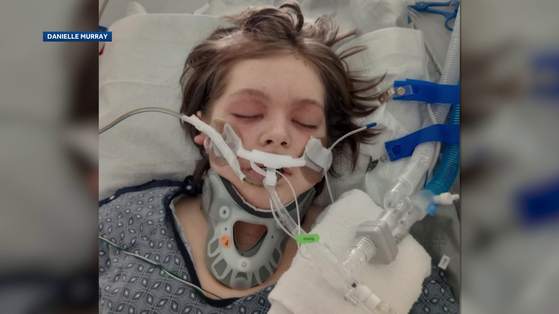 Tree falls on boy, 12, walking home from bus stop in Boscawen; in ...