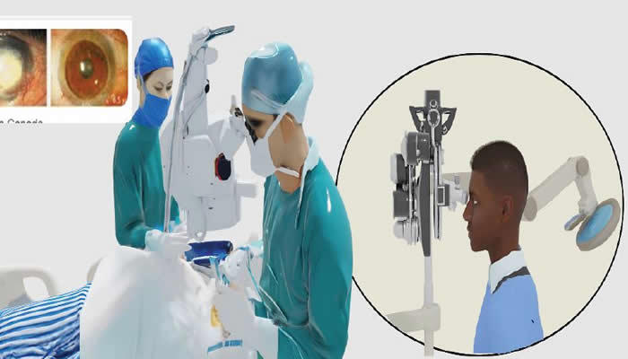 Stem cell therapy: Breakthrough for repairing corneas, restoring sight