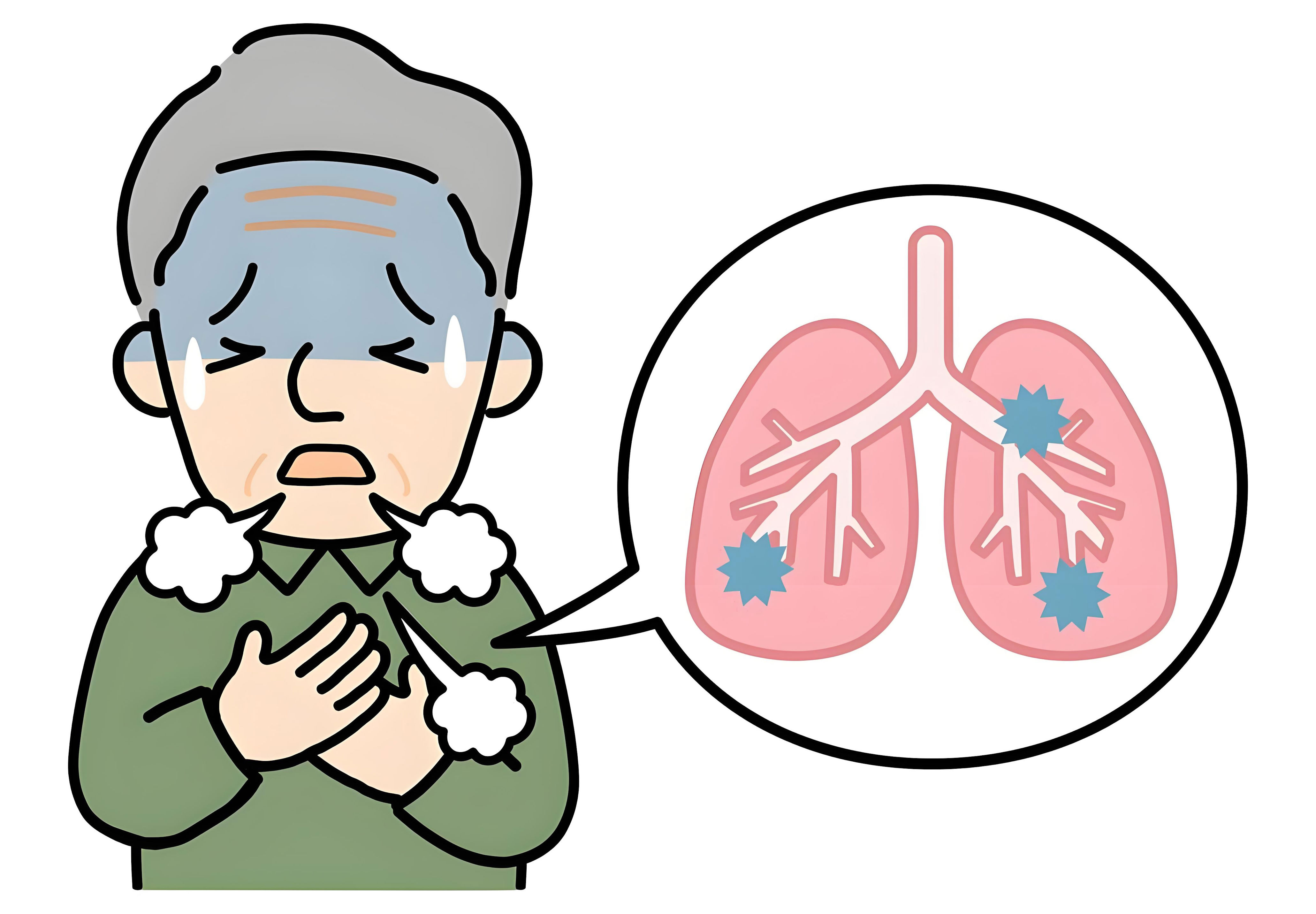 毒性远超砒霜！男子中招致肺部“发霉”，这种病菌如何避开？