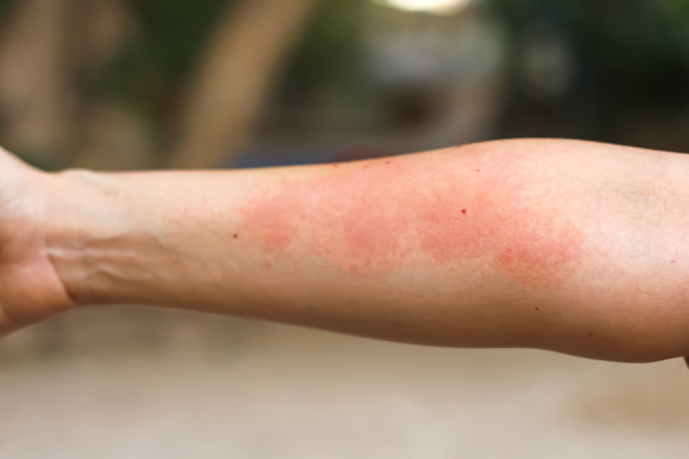 Medical Experts Reveal: This Is the Fastest Way to Heal a Wound