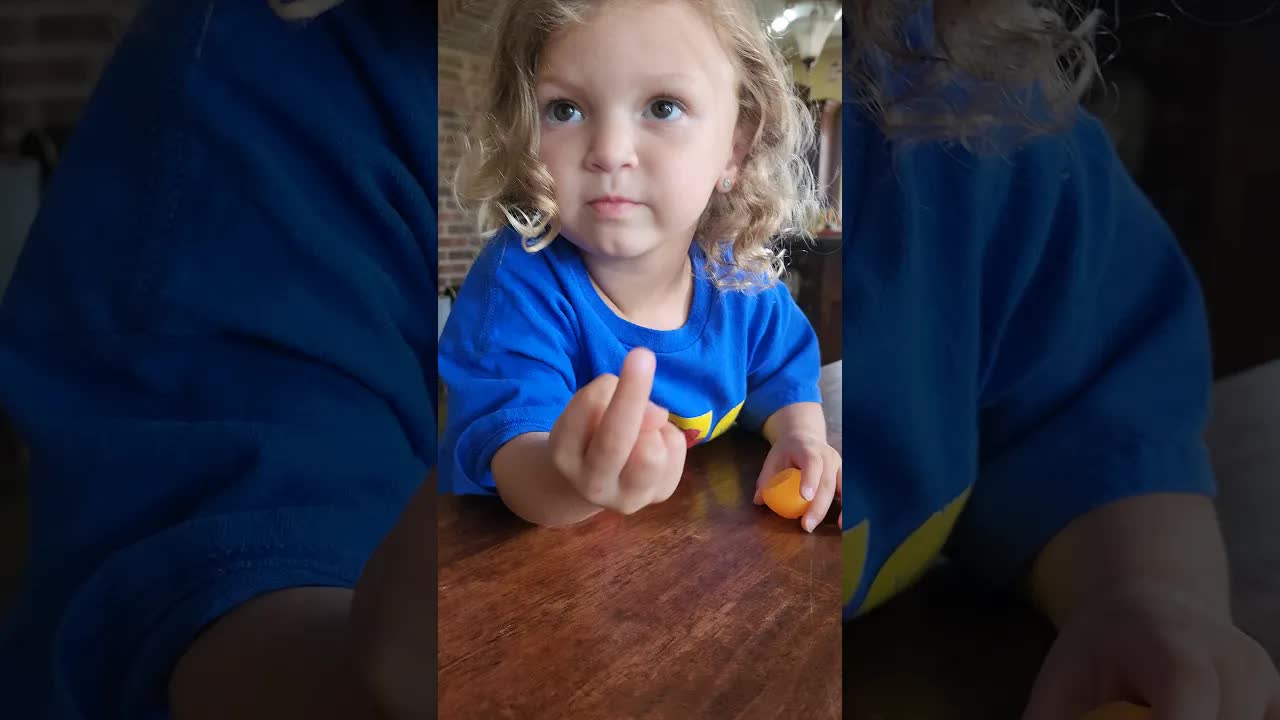Toddler Shows Off Her Boo-Boo