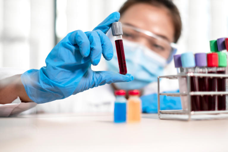 Blood type B could hold the key to slower aging, researchers say