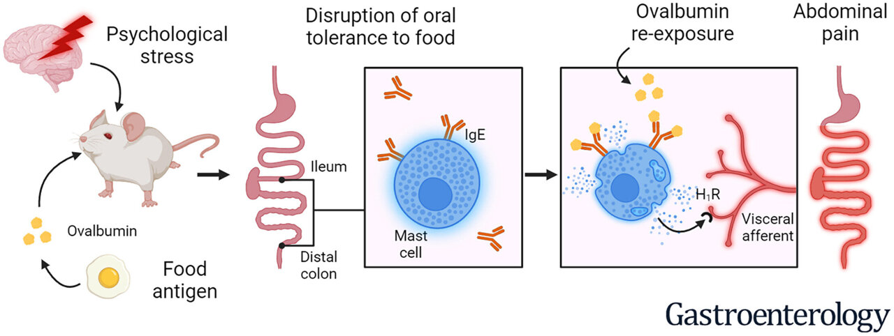 Psychological stress may cause food-induced symptoms in IBS