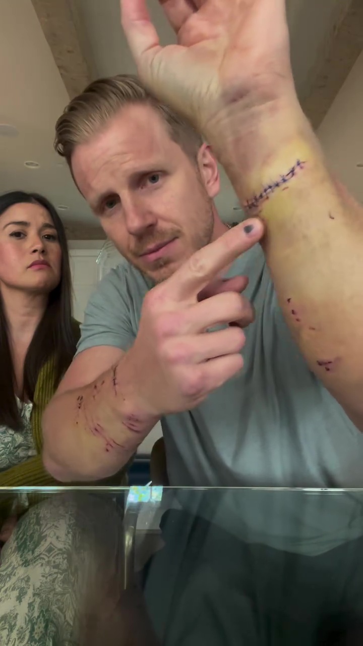 ‘Bachelor’ alum Sean Lowe attacked by his dog twice in 12-hour span: ‘I ...