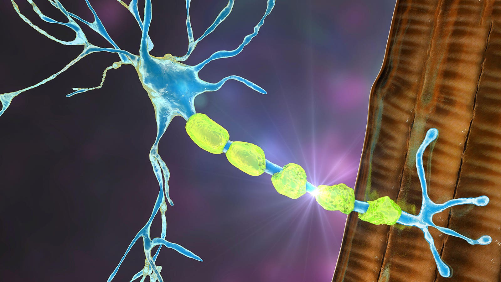 Diagnosing Pediatric and Late-Onset Multiple Sclerosis