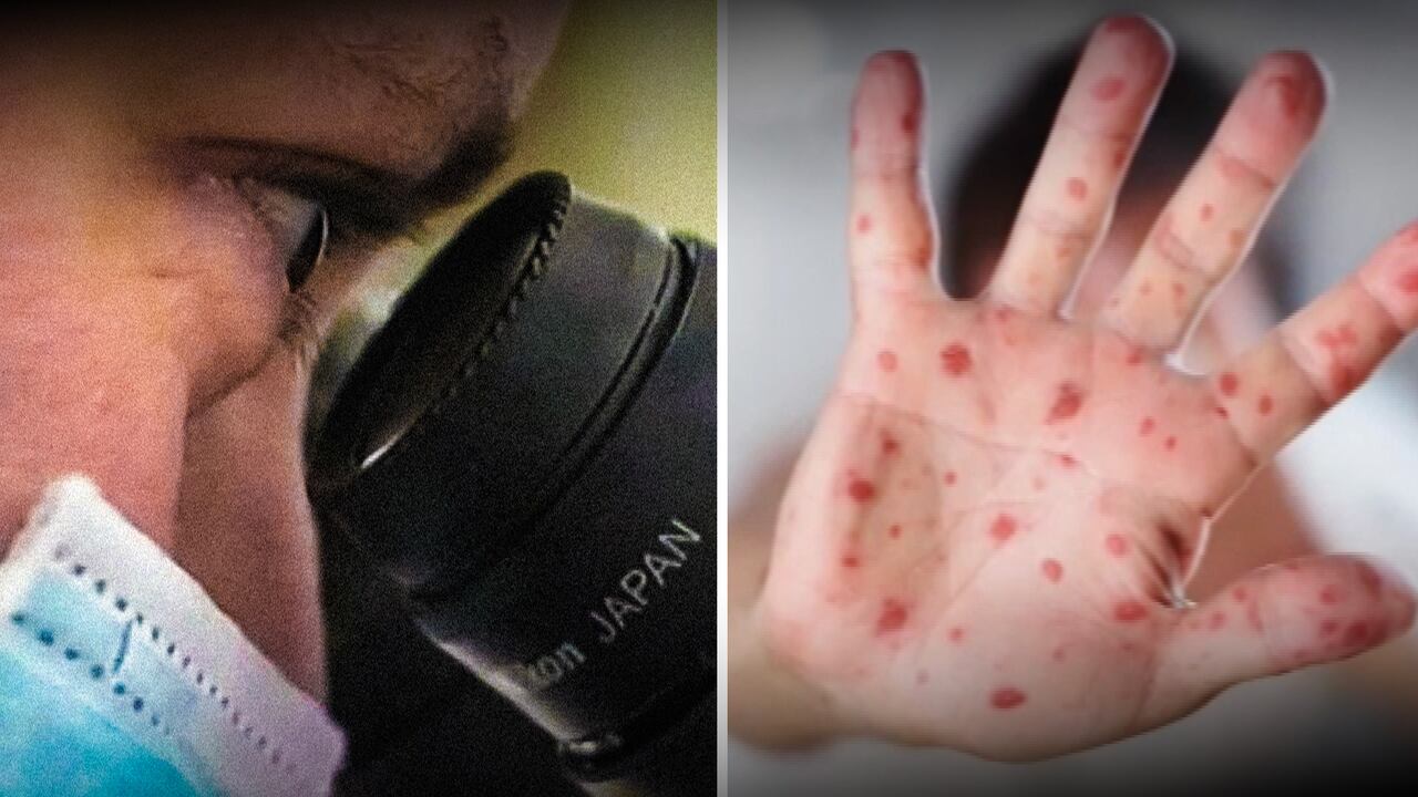 How to track down your measles immunization records