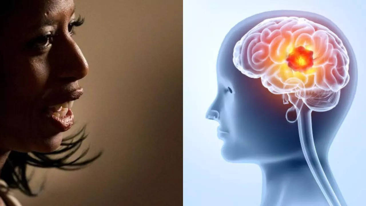 What Is Glioblastoma, the Aggressive Brain Cancer That Killed Former US ...