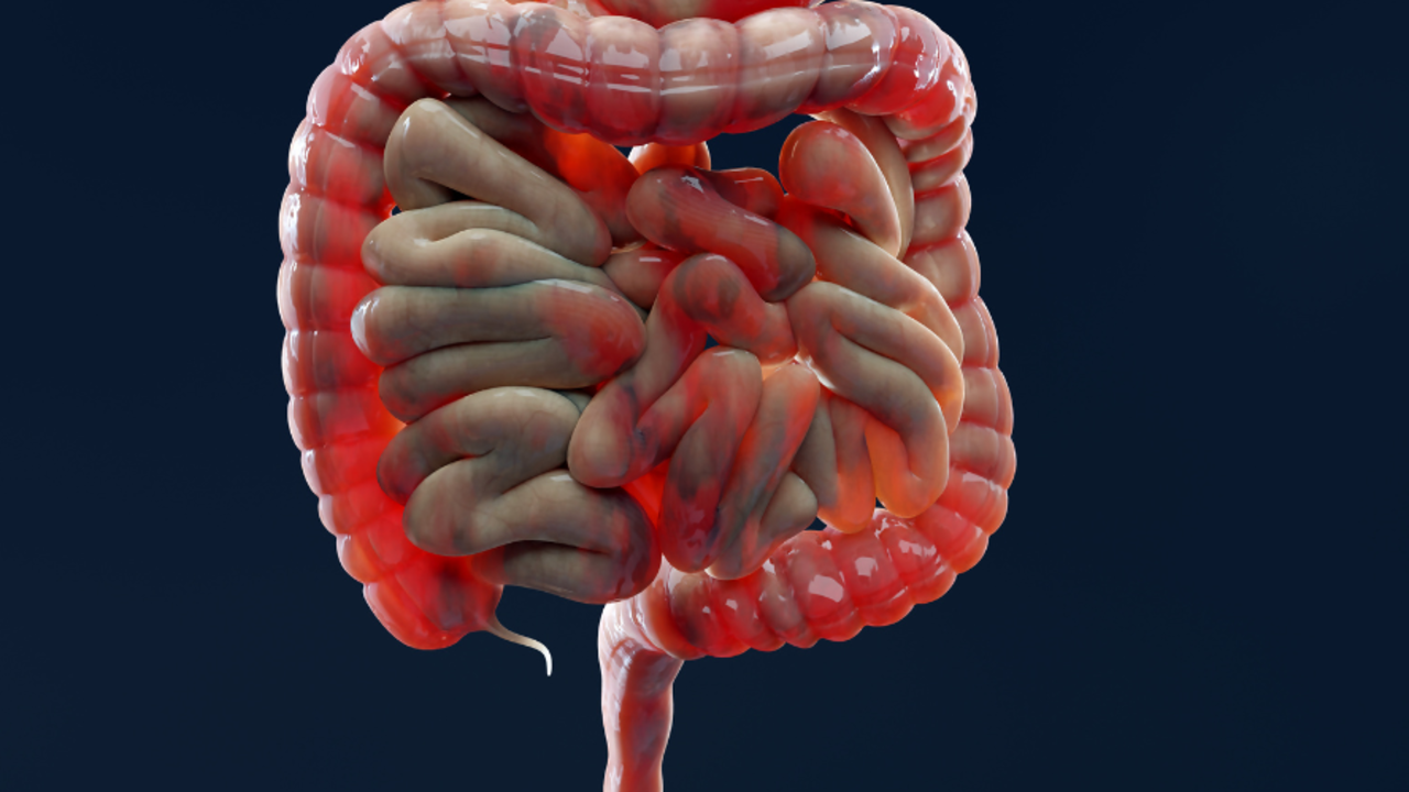 FDA Approves Tremfya For Active Crohn's Disease