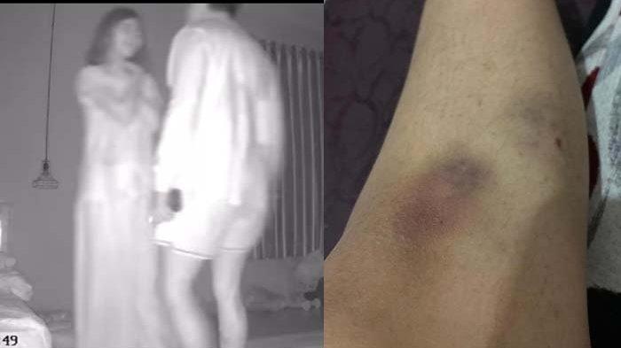 SOSOK Selebgram Adelia Septa,Curhat Alami KDRT dari Suami,Sang Mertua ...