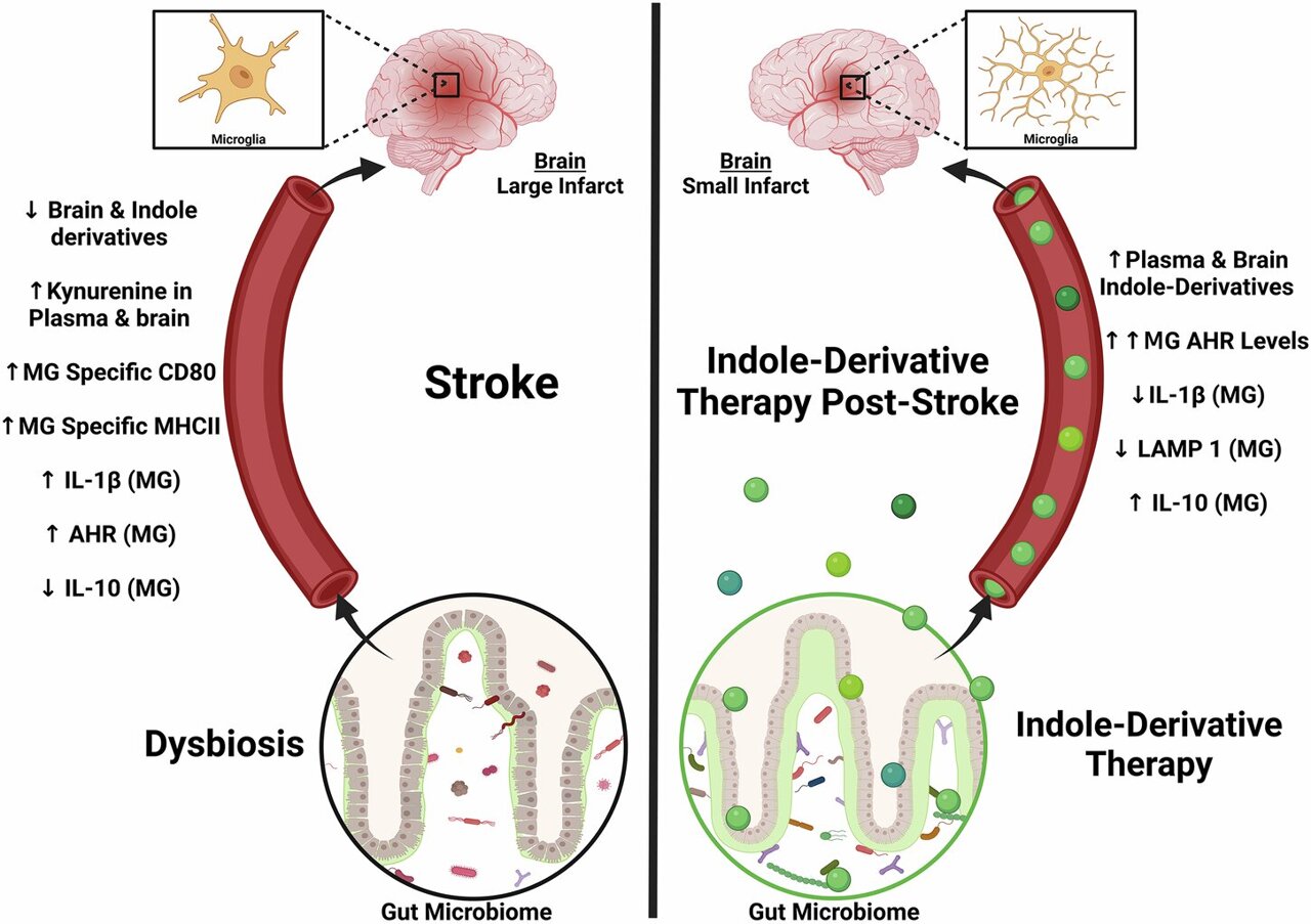 Correcting gut microbiota imbalance after stroke can reduce brain ...